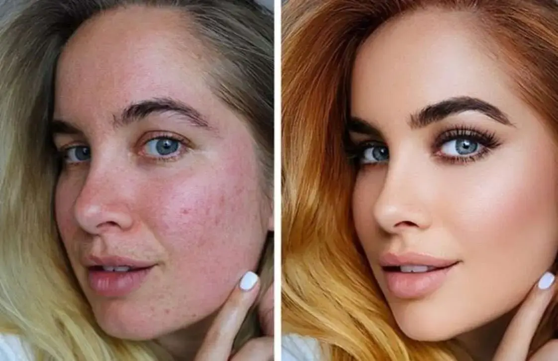 Instagram Face en la Moda: La Tendencia que Define la Belleza Digital ...